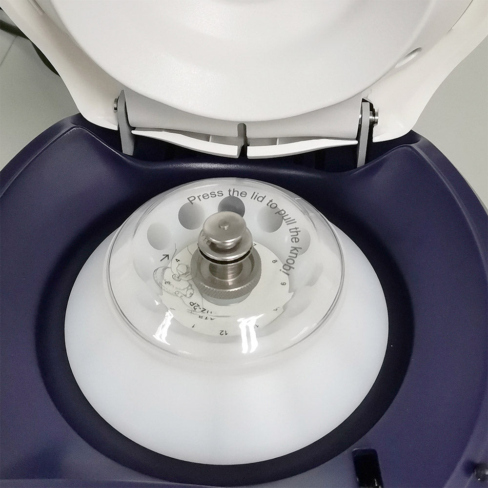 Centrifuge 2012 High Speed Mini Centrifuge with Rotor – lab1st-eshop Centrifuge 2012 High Speed Mini Centrifuge with Rotor – lab1st-eshop